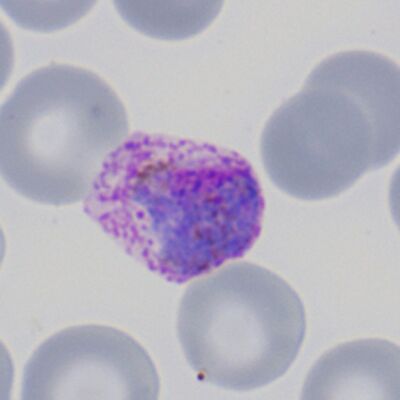 Gallery of gametocytes - MalariaETC