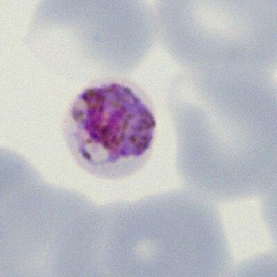 Gallery of gametocytes - MalariaETC