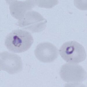 P.knowlesi early trophozoites gallery - MalariaETC