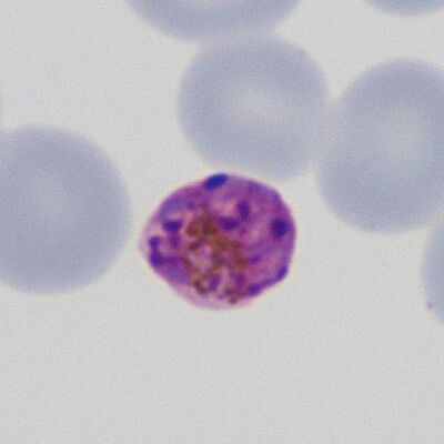 Gallery of schizonts - MalariaETC