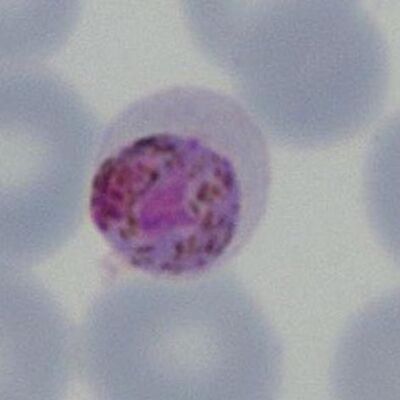 Gallery of gametocytes - MalariaETC