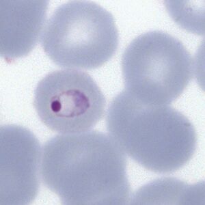 Gallery of early trophozoites - MalariaETC