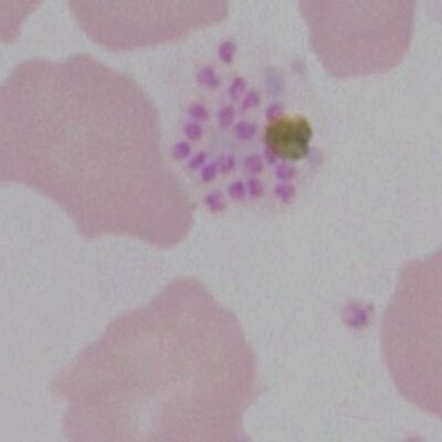 Gallery of schizonts - MalariaETC
